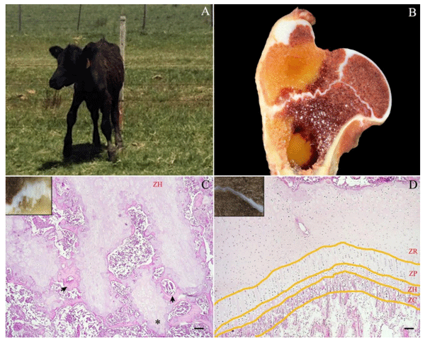 Raquitismo debido a deficiencia crónica de fósforo: reporte de un brote ...