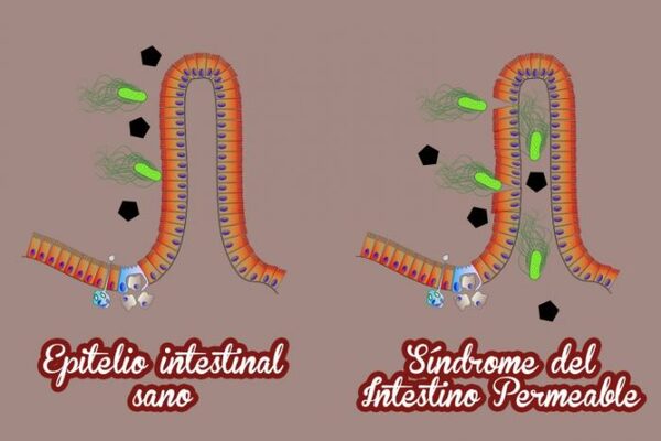 Importancia del síndrome del intestino permeable en animales de granja ...