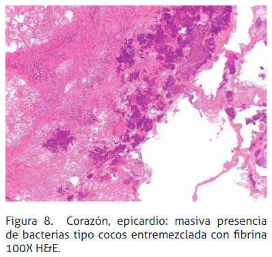Reticulopericarditis traumática: reporte de un caso | El Productor