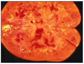 Micotoxinas: Qué hacer con la amenaza de la micotoxicosis - Engormix