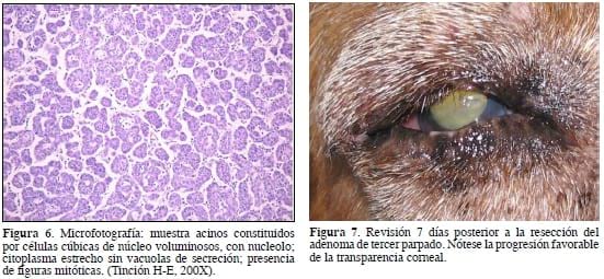 Ceguera unilateral secundaria a un adenoma de la glándula del tercer ...
