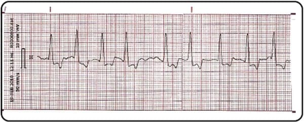 Utilidad de la electrocardiografía en la clínica veterinaria de ...