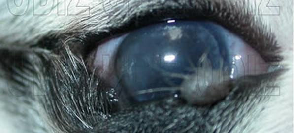 Quiste Dermoide | Engormix