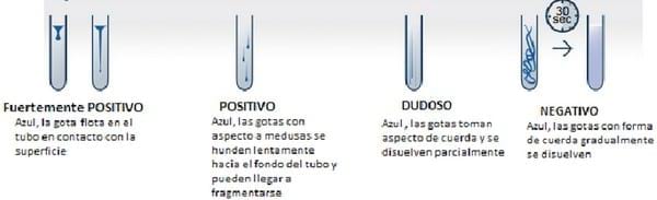 ACTUALIZACIÓN SOBRE PERITONITIS INFECCIOSA FELINA(PIF) Y DESCRIPCIÓN DE ...