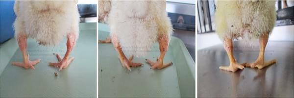 Varus y valgus. Deformación de la articulación intertarsal. Manejo ...