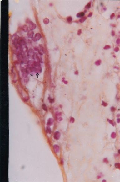 Intranuclear inclusion bodies of ILT | Engormix