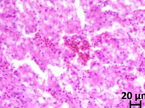 liver problem in cobb 400 y broiler | Engormix