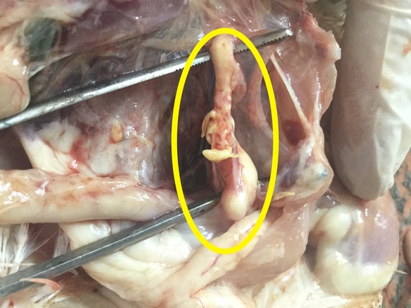 Salpingitis Engormix