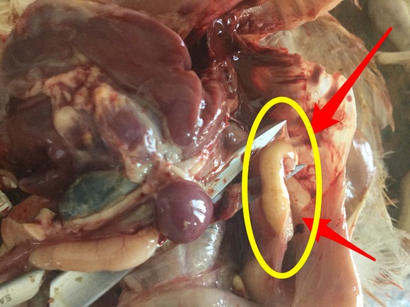 Salpingitis Engormix