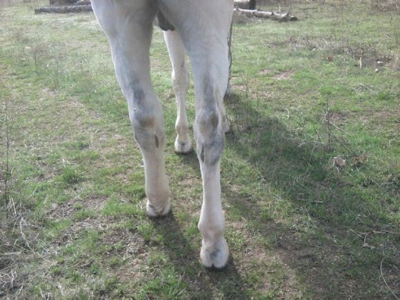 linfangitis. Ref: 14803