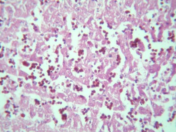 HISTOMONIASIS. Ref: 8366