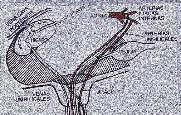 Onfalitis en el recién nacidoy sus consecuencias. Ref: 54588